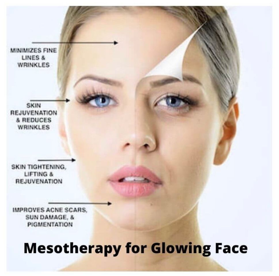 Mesotherapy – 130 Dental Centre